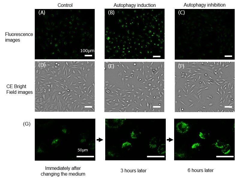 Autophagy Analysis | Yokogawa Deutschland GmbH