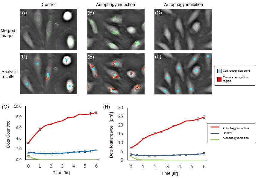 Autophagy Analysis | Yokogawa Deutschland GmbH