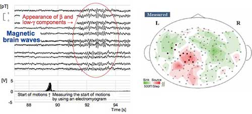 Neuroscience and Measuring Brain Functions | Yokogawa Deutschland GmbH
