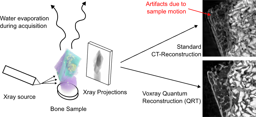 Automatic motion correction in life science | Voxray