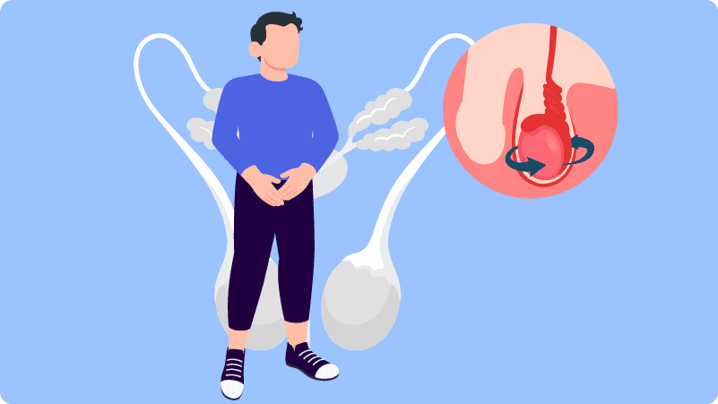 Torsión Testicular Evaluación Diagnóstico Y Tratamiento