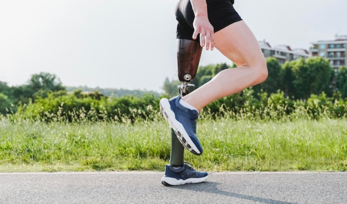 Calidad de vida y funcionalidad en el paciente amputado