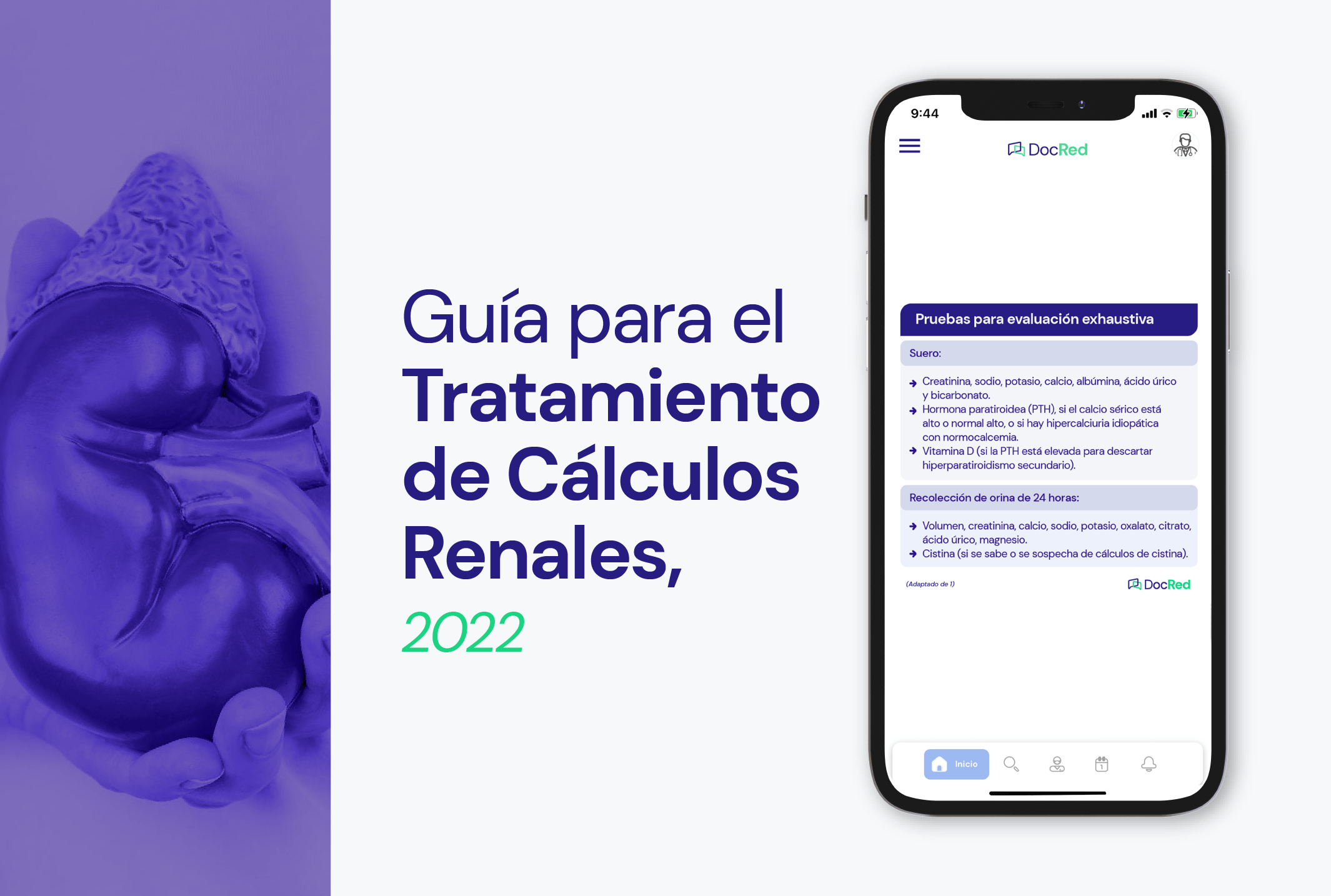 Guía para el Tratamiento de Cálculos Renales, 2022