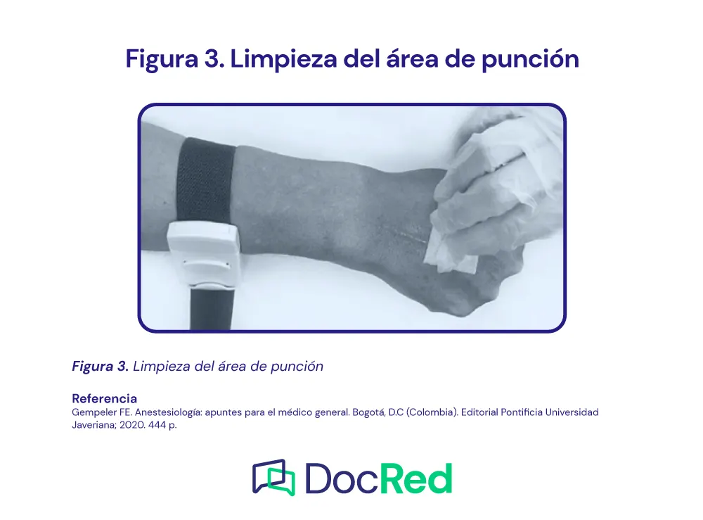 Guía práctica para canalización venosa periférica - Docred