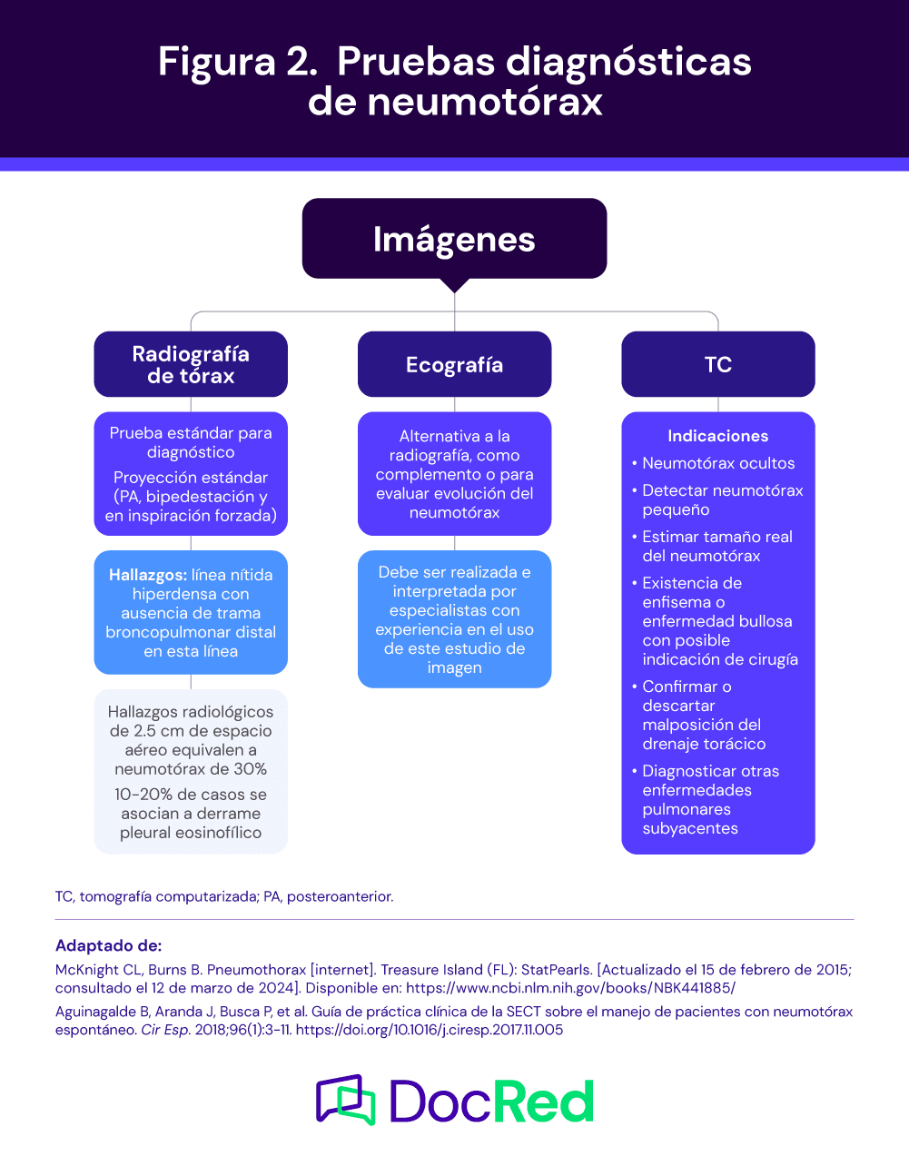 Neumotorax Síntomas Y Tratamiento – GZNQ