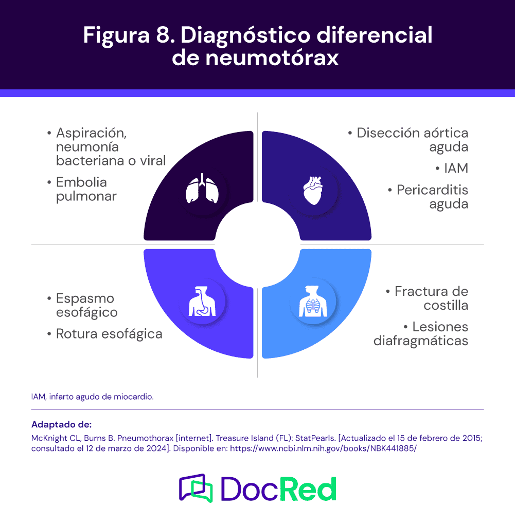 GPC 2023: guía de diagnóstico y tratamiento de neumotórax