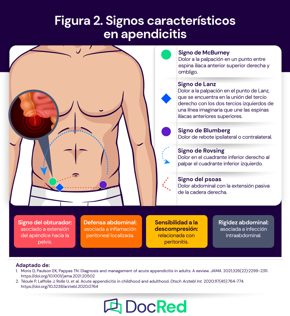 Primeros Sintomas De Apendicitis Cómo Identificar Apendicitis: