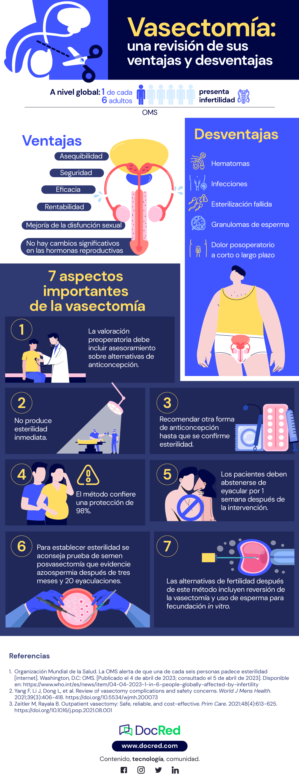 Vasectomía: una revisión de sus ventajas y desventajas