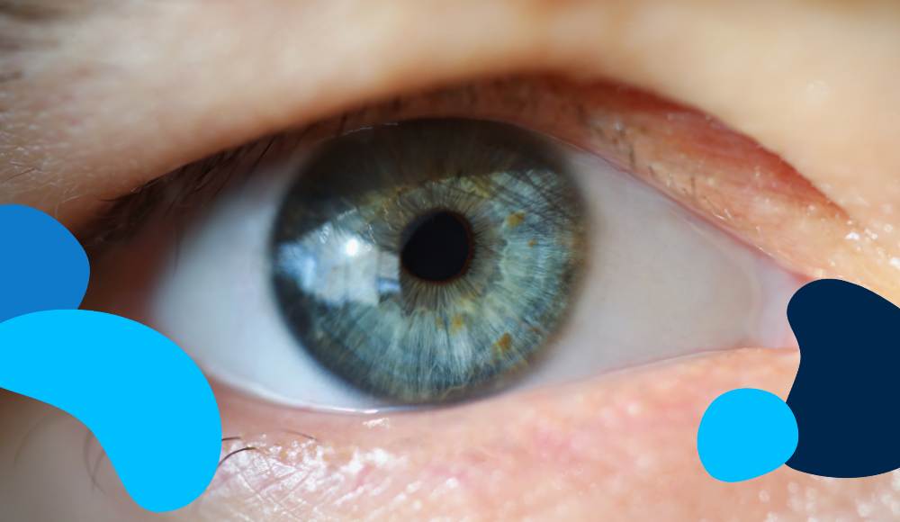 Palpebre cadenti: sintomi, cause e cure | Doctolib