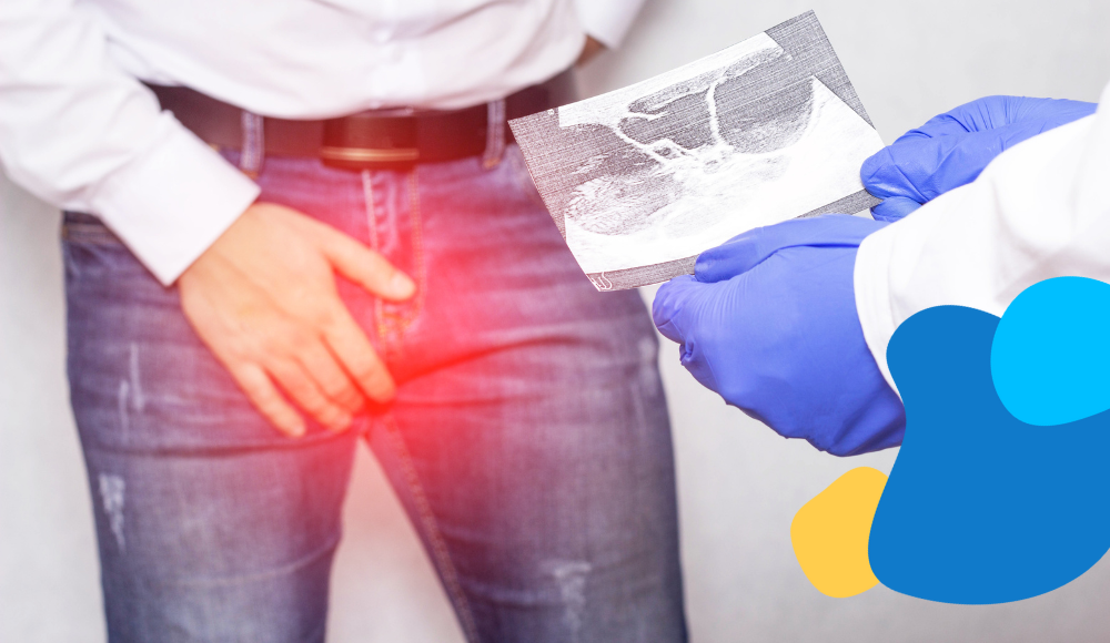 Orchite: cos'è, cause, sintomi e cure - Doctolib