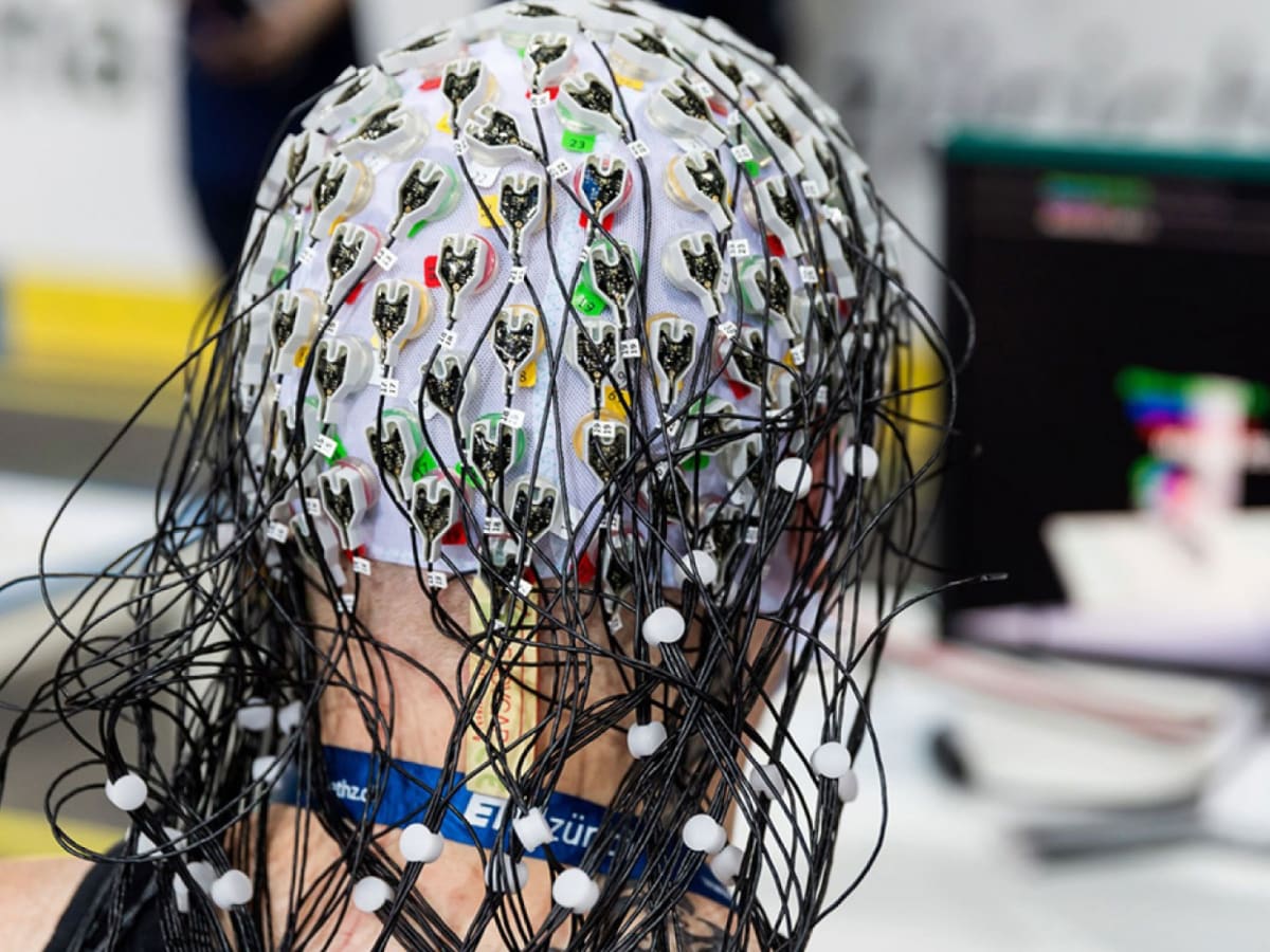 Brain-computer interfaces