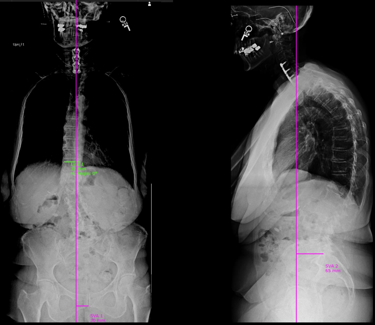 Spine care | Prosser Memorial Health