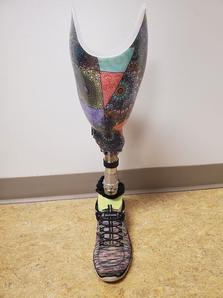 Orthotics and prosthetics | Mercyhealth