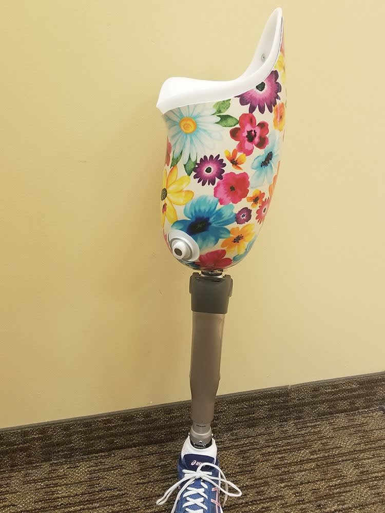 Orthotics and prosthetics | Mercyhealth