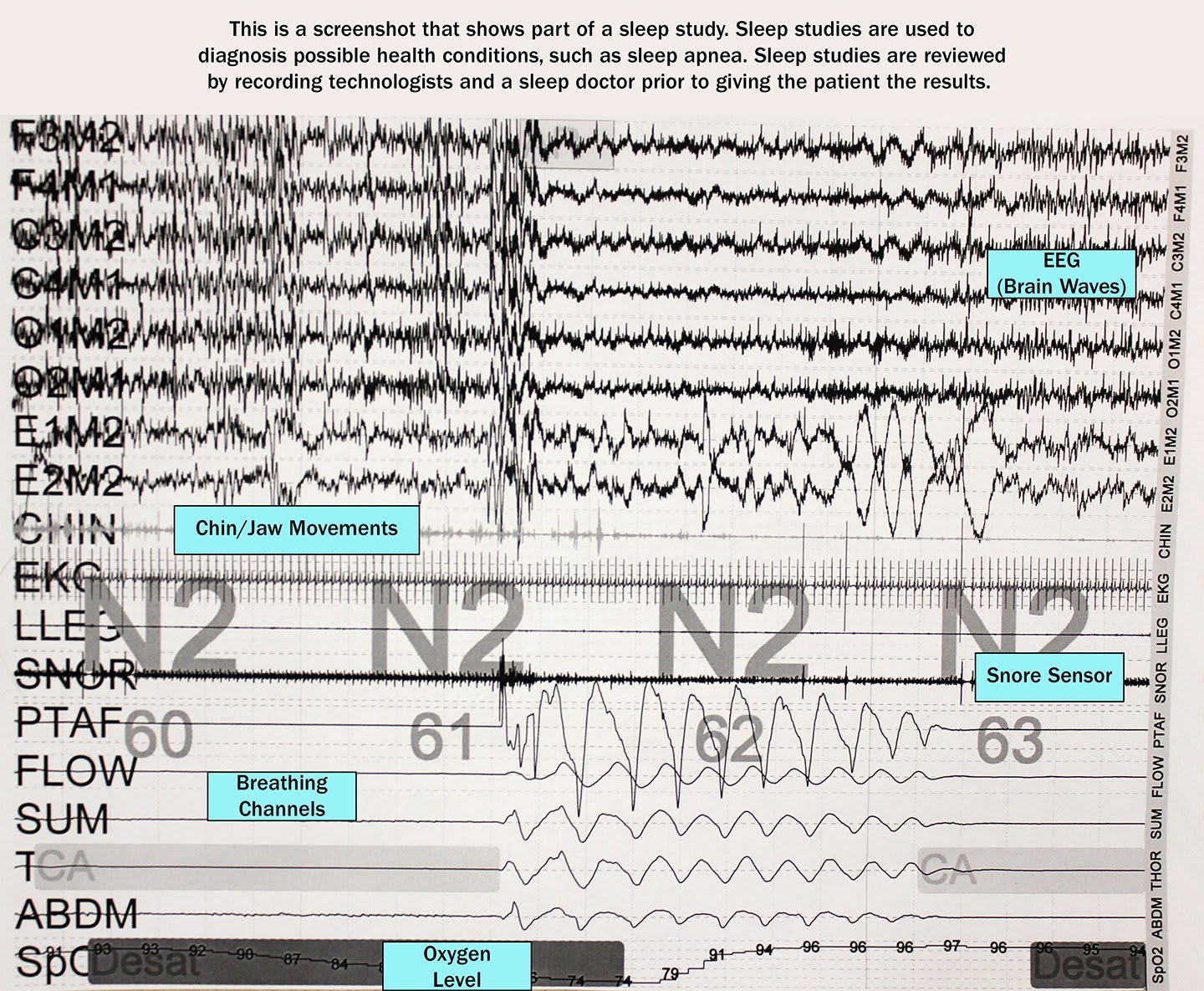 Sleep disorders | Pella Regional Health Center