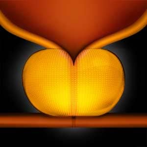 UroLift | Pella Regional Health Center