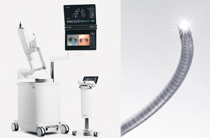 The power of robotic bronchoscopy | SRHC