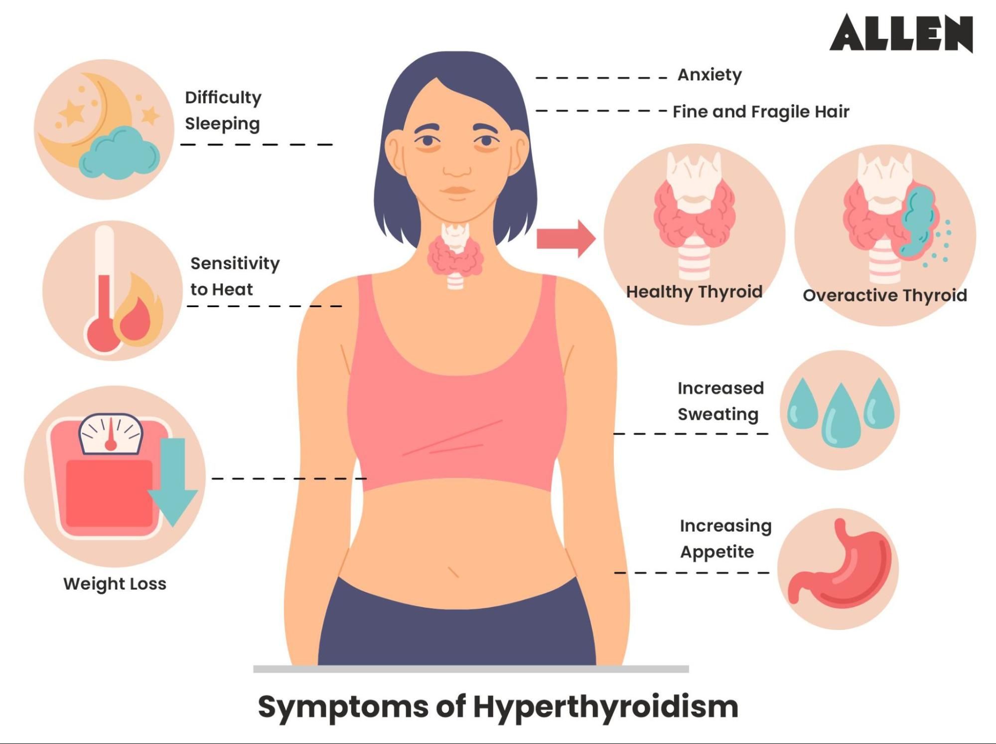 Thyroid Gland: Anatomy, Structure, Function & Disorders