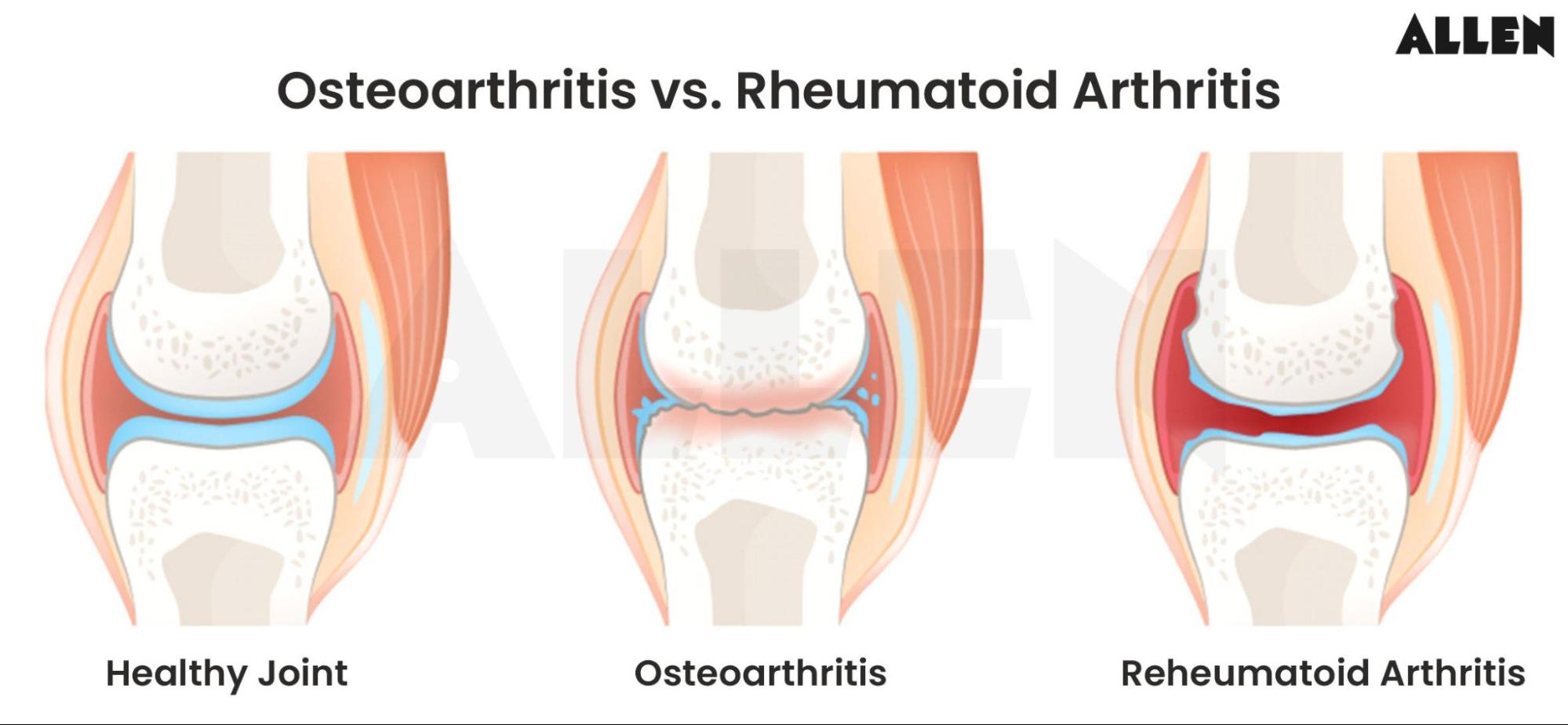 Locomotion and Movement: Types of Movements, Skeletal System and Disorders
