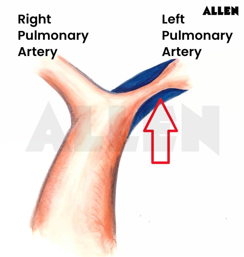 Pulmonary Artery: Anatomy, Function, Histology
