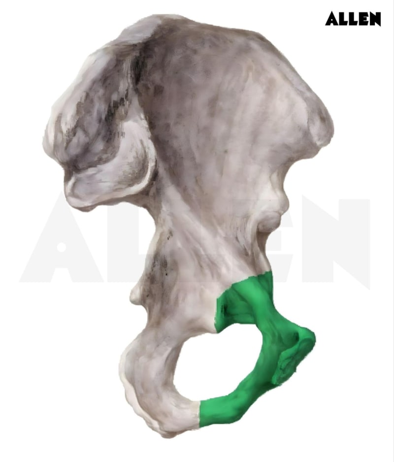 Ischium: Anatomy, Functions and Clinical Relevance