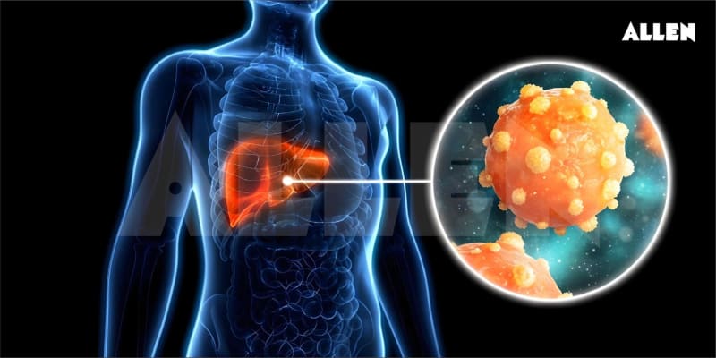 Hepatitis: Types, Causes, Symptoms & Treatment