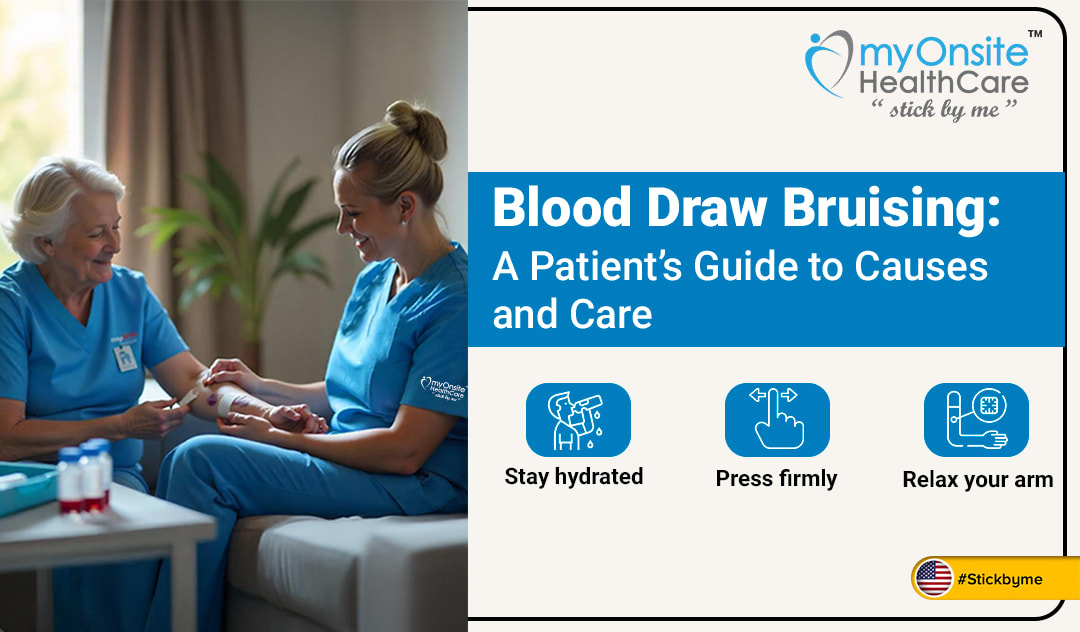 What to Know About Bruising After a Blood Draw