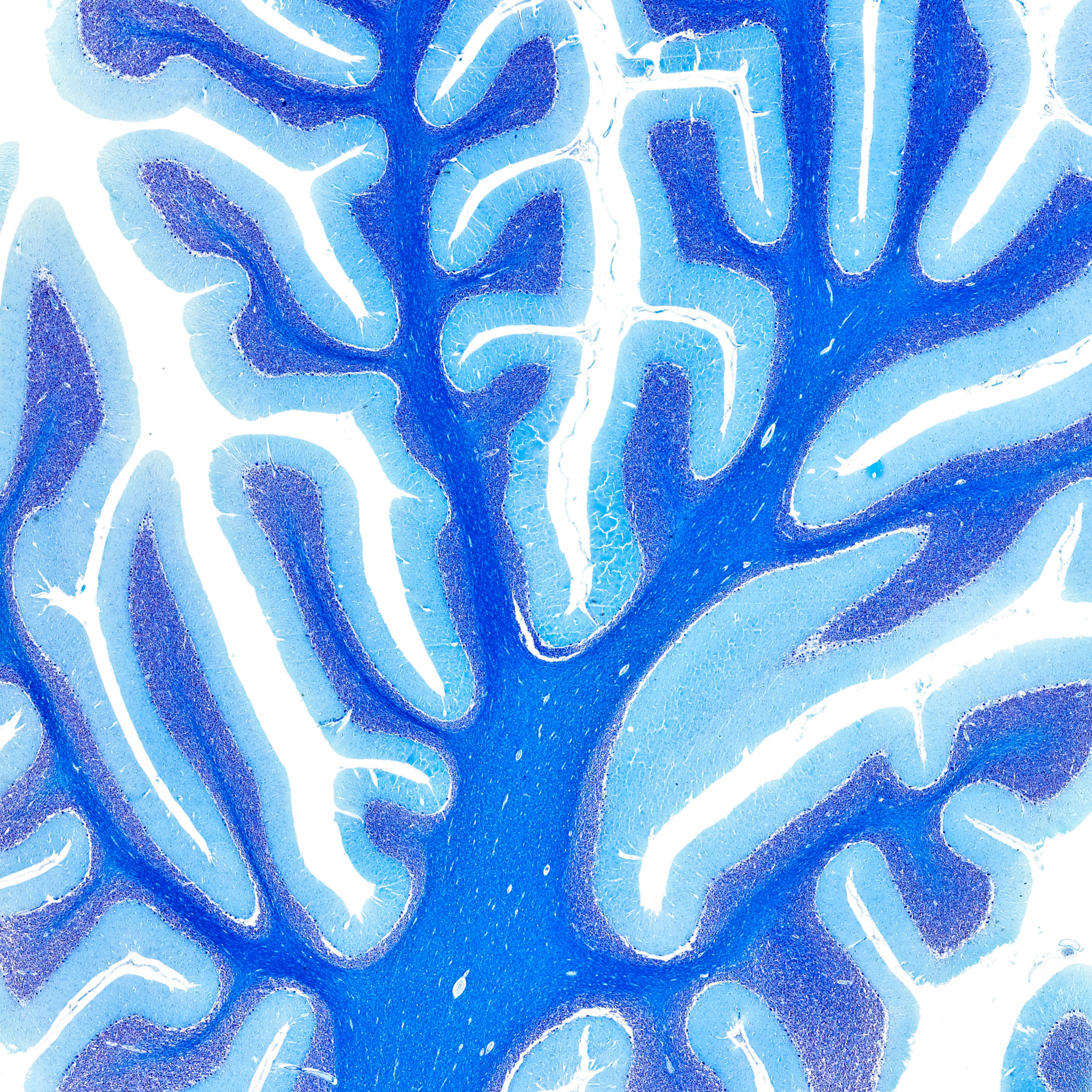 Focus and Concentration Support Supplement Protocol - SuppCo