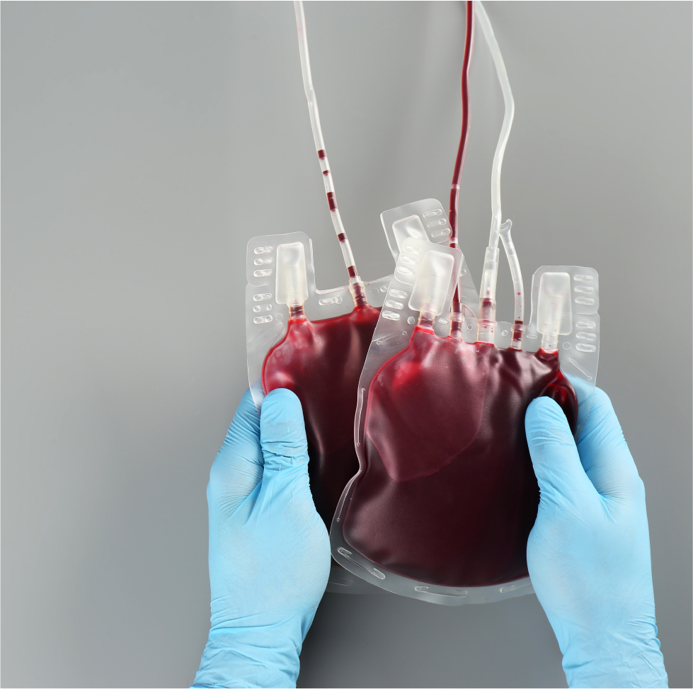 Deep Vein Thrombosis and Pulmonary Embolism, Blood Transfusions