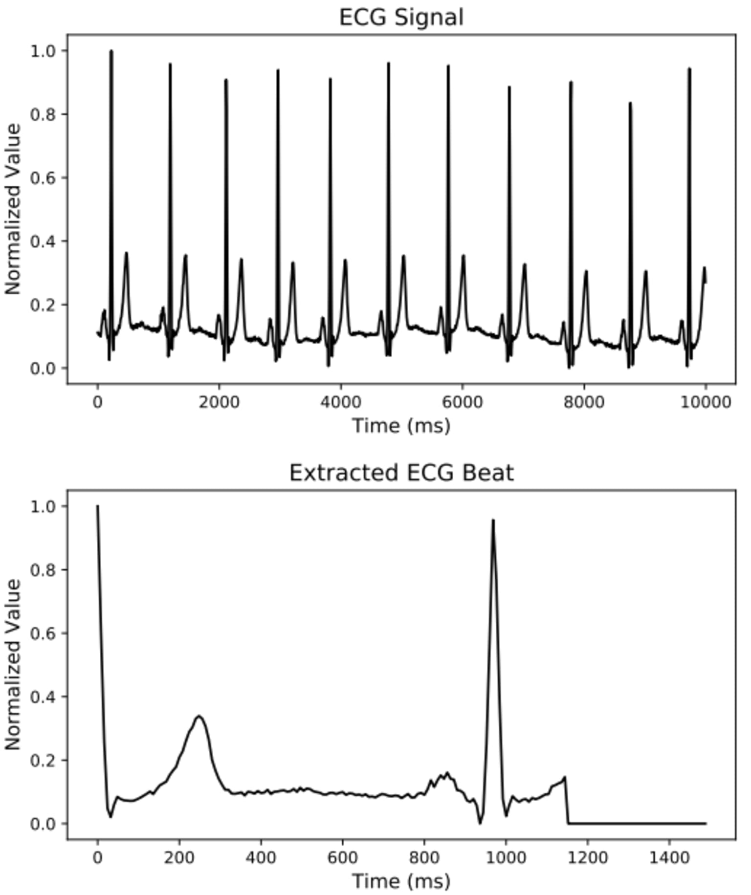 Learn How to Classify ECG Signals with DL in KNIME | KNIME