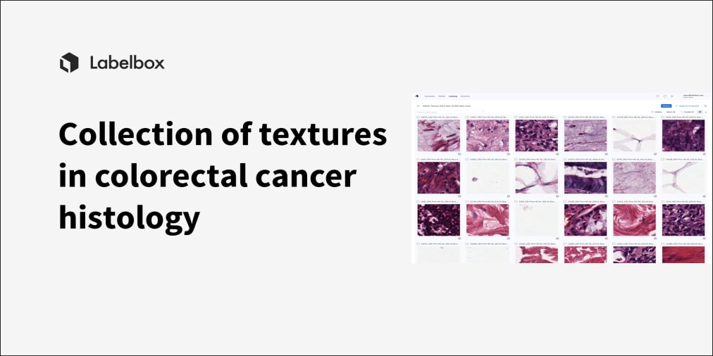 Collection of textures in colorectal cancer histology