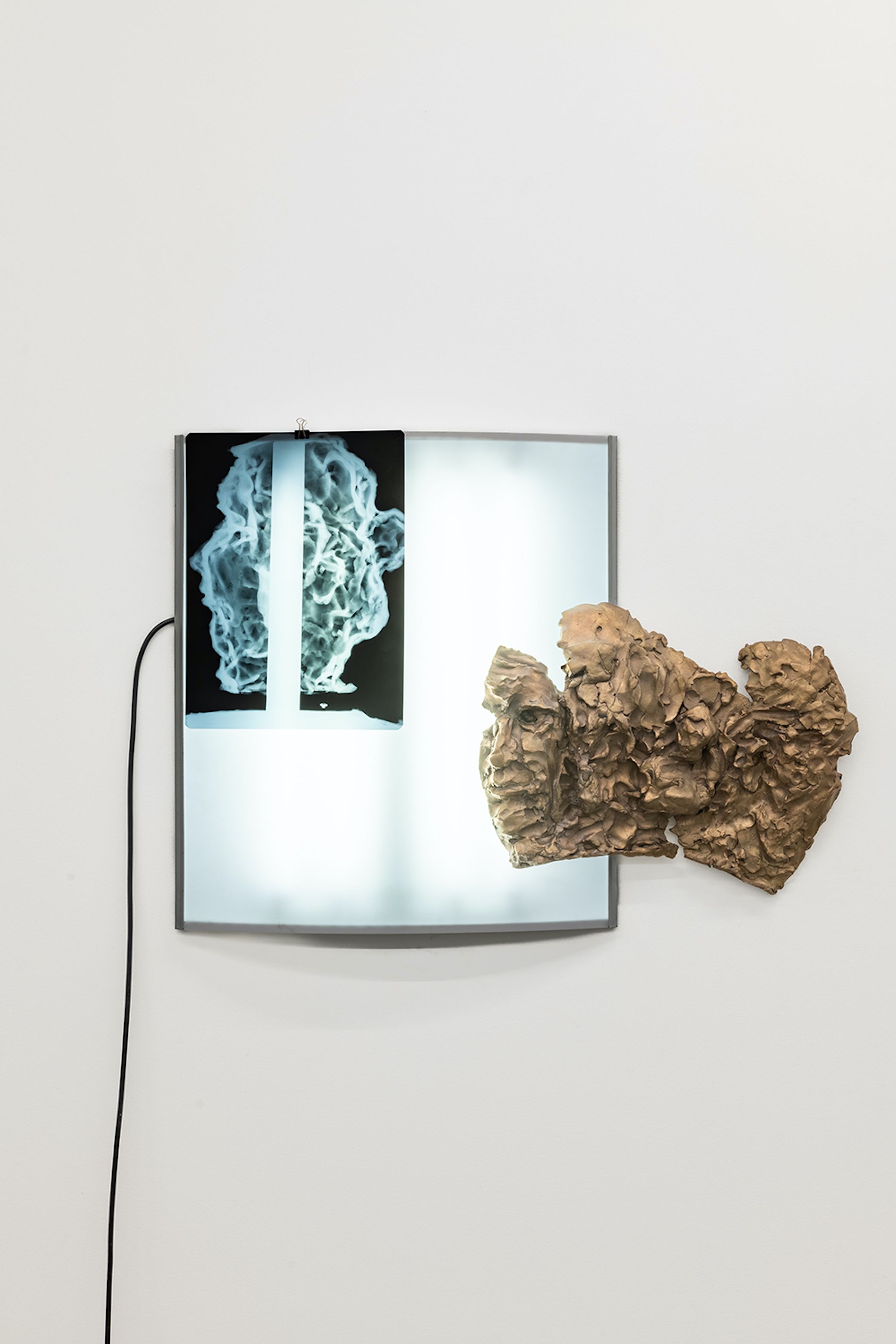 Xray I | Sander Breure & Witte van Hulzen | Gallery View...