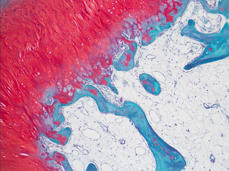 Safranin Staining: A Versatile Technique for Visualizing Biological ...