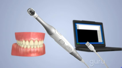 Intraoral Camera | Monterey, CA | Joshua E. Drais, DDS