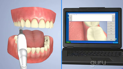 Intraoral Camera | Monterey, CA | Joshua E. Drais, DDS