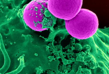 MRSA | National Geographic Society