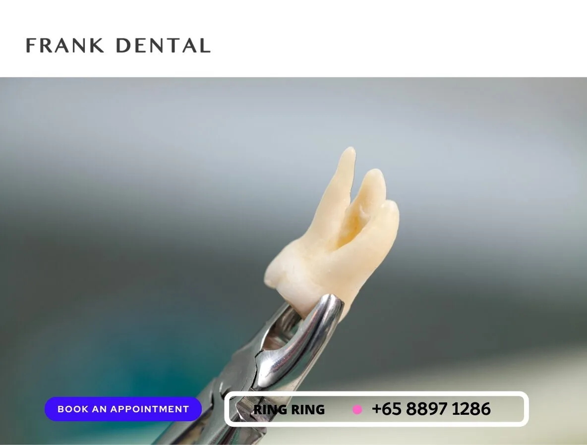 Can I Pay For All My Teeth Extraction Cost With Medisave? | Frank Dental