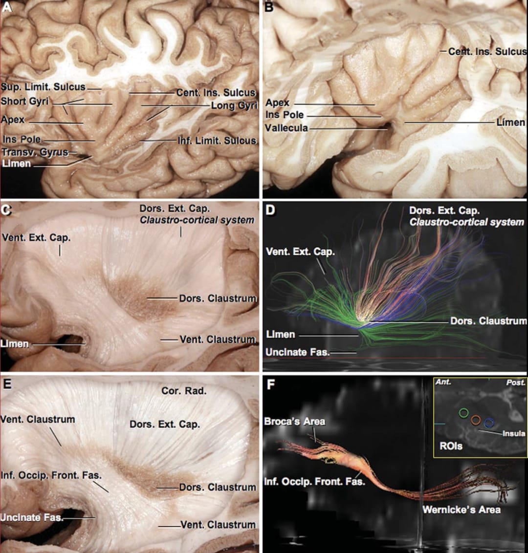 Insular Region | Neuroanatomy | The Neurosurgical Atlas