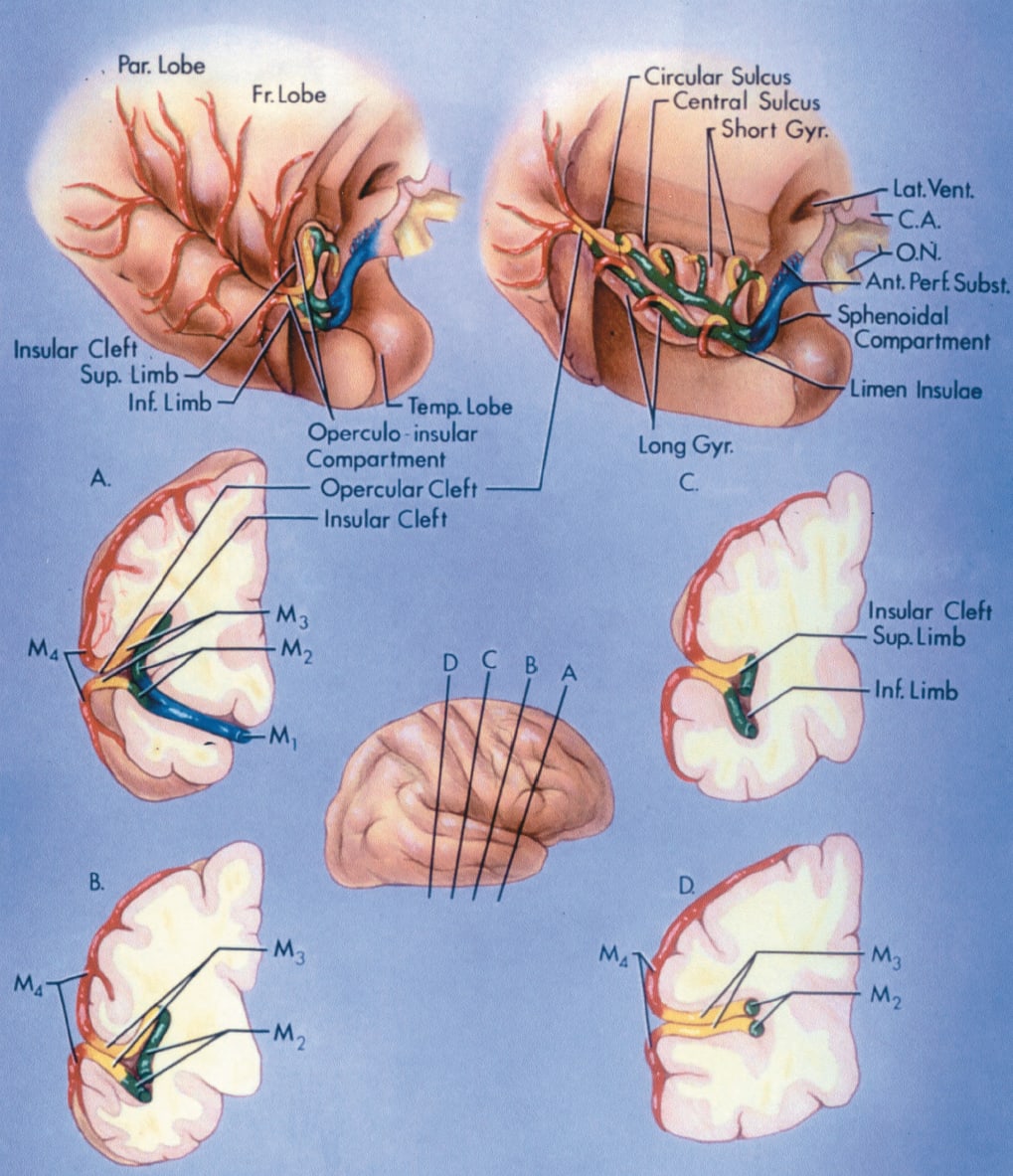 Relationship of the M1, M2, M3, and M4 Segments of the Middle Cerebral ...
