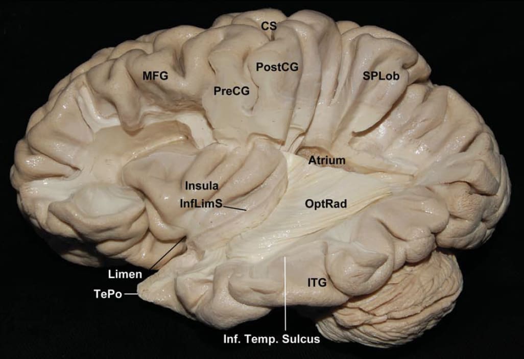 Lateral view of Cerebral Hemisphere | Neuroanatomy | The Neurosurgical ...