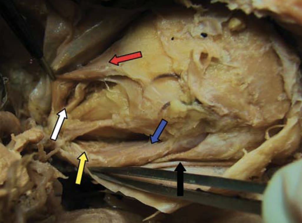 A Superior View of the Left Orbit | Neuroanatomy | The Neurosurgical Atlas