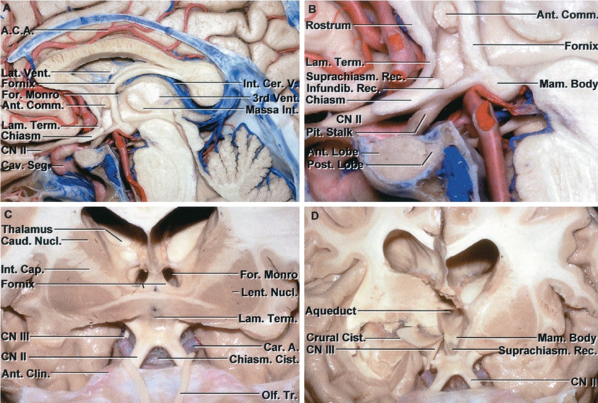 Neural Relationships in the Suprasellar Area | Neuroanatomy | The ...