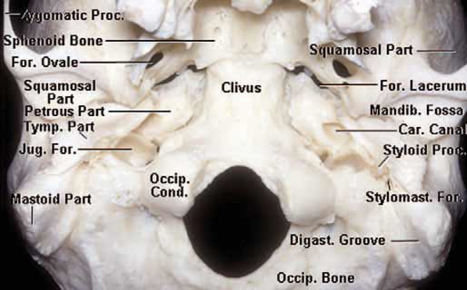 Inferior View of the Middle and Posterior Cranial Base | Neuroanatomy ...