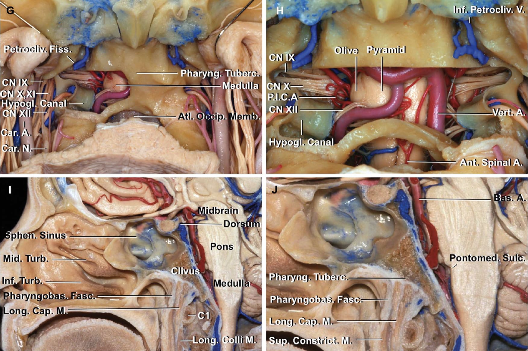 Stepwise Dissection Focusing on the Lower Clivus | Neuroanatomy | The ...