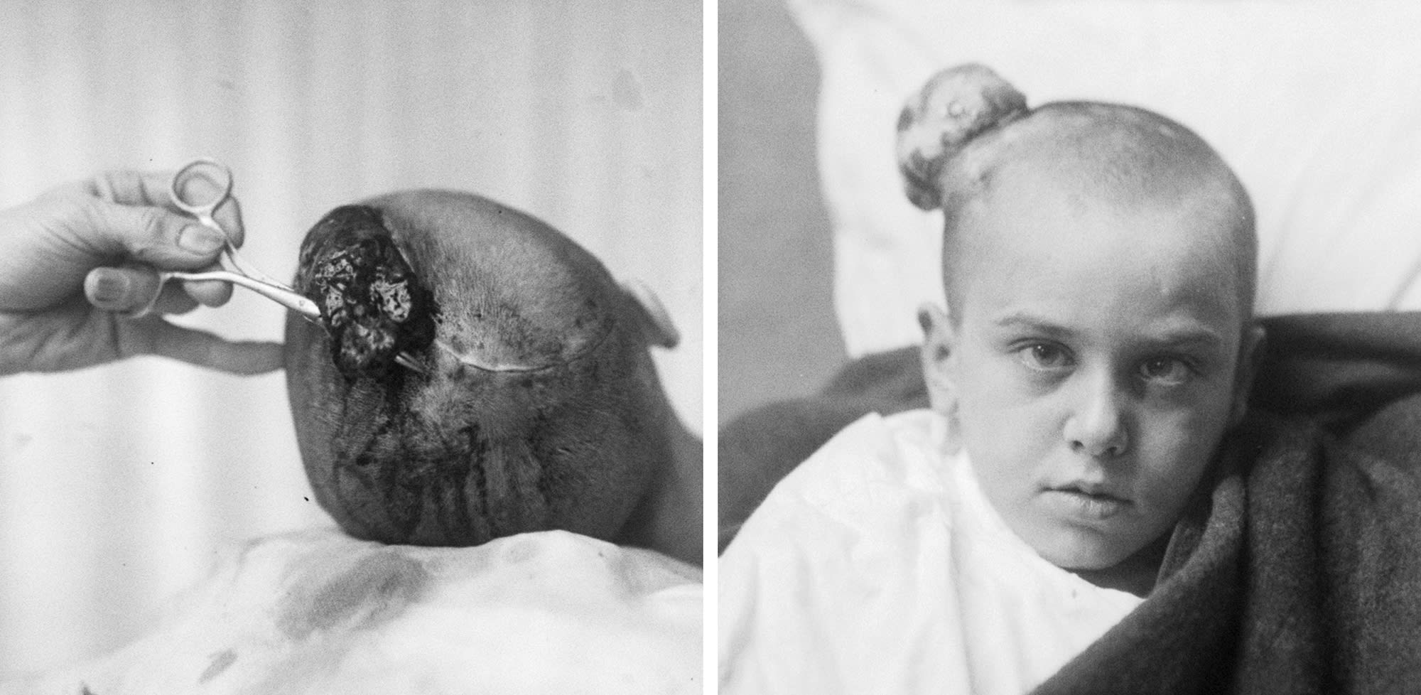 Scalp Incisions | Cohen Collection | Volumes | The Neurosurgical Atlas