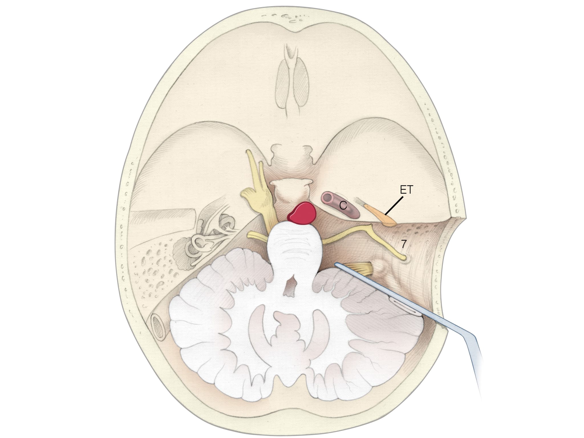 Vascular Considerations | Jackler Collection | Volumes | The ...