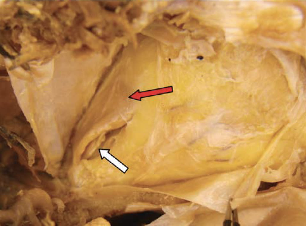 Superior View of the Left Orbit | Neuroanatomy | The Neurosurgical Atlas