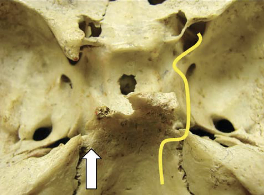 Superior View of the Sellar Region | Neuroanatomy | The Neurosurgical Atlas