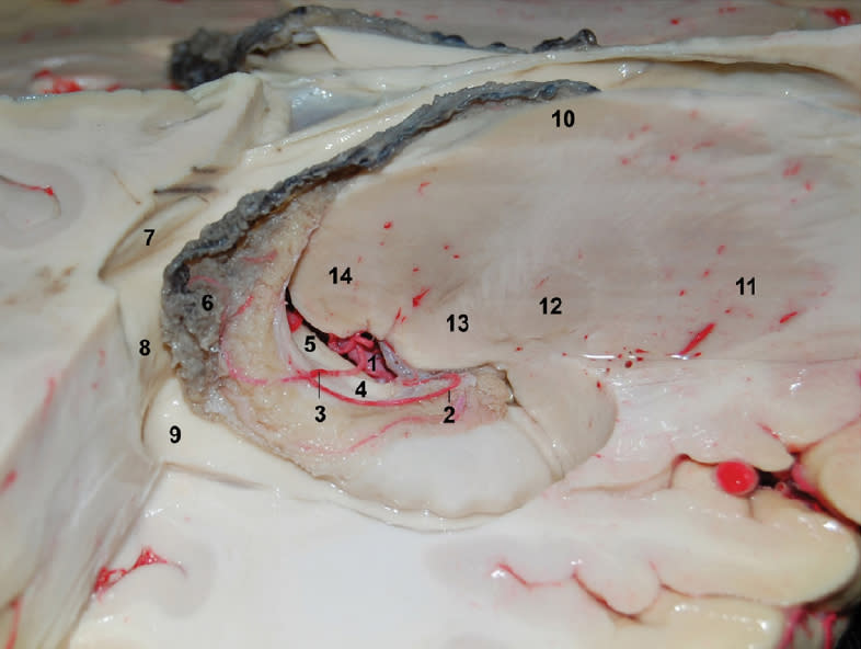 View of a Lateral Section of the Brain | Neuroanatomy | The ...