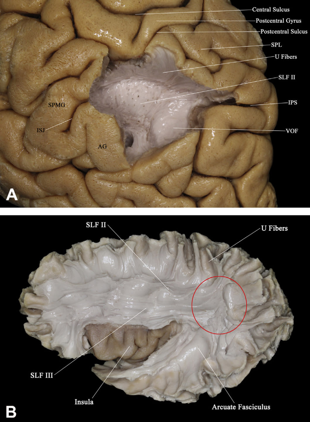 Lateral View of the Brain Centered at the Level of the Intraparietal ...